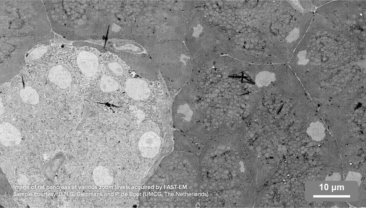 FAST-EM | Ultra-fast automated multibeam electron microscope